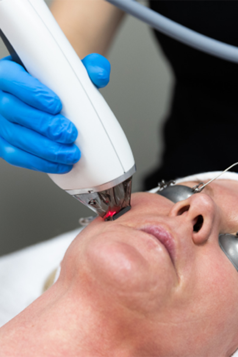 MOXI - BioBalance Skin